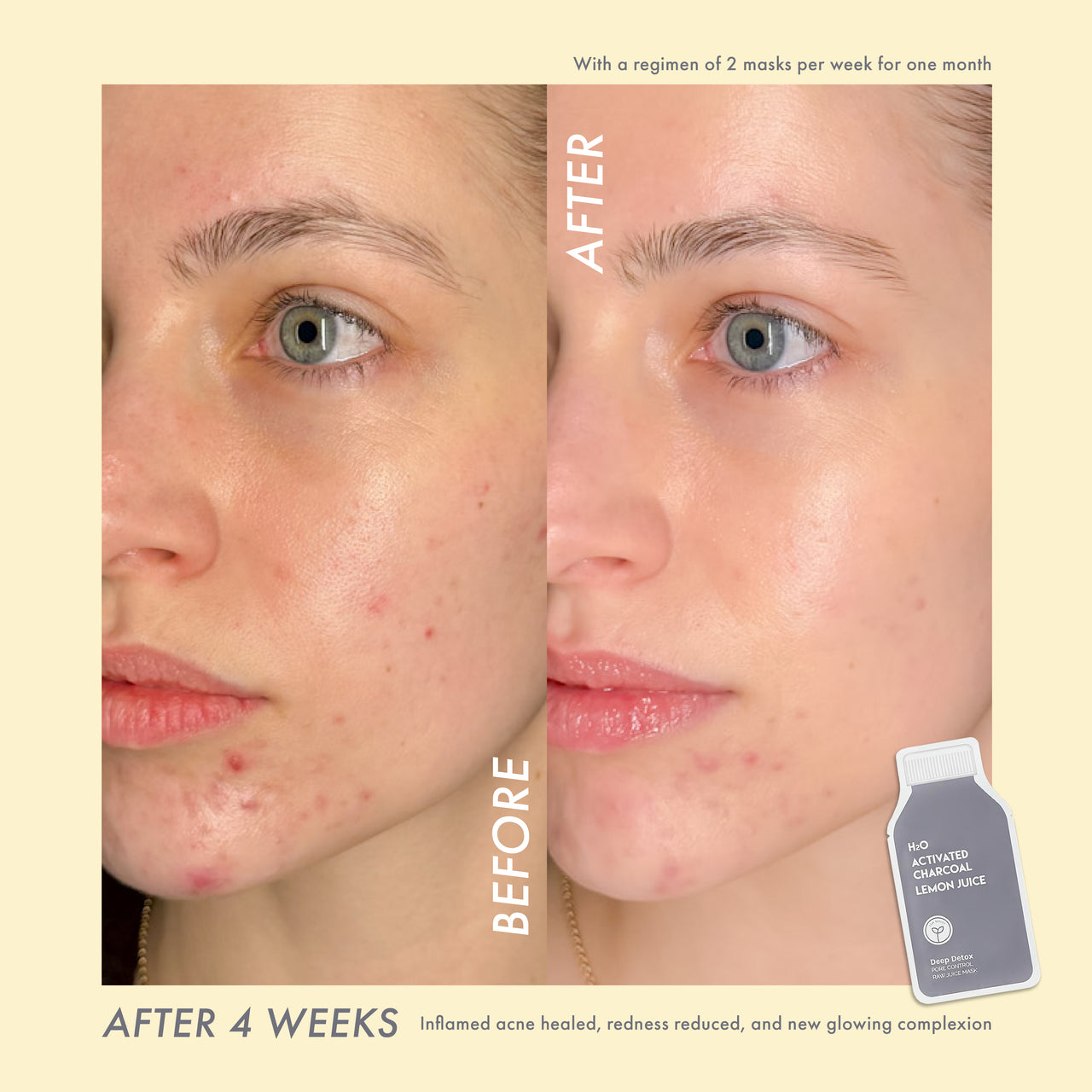 Deep Detox Pore Control Raw Juice Mask | ESW Beauty